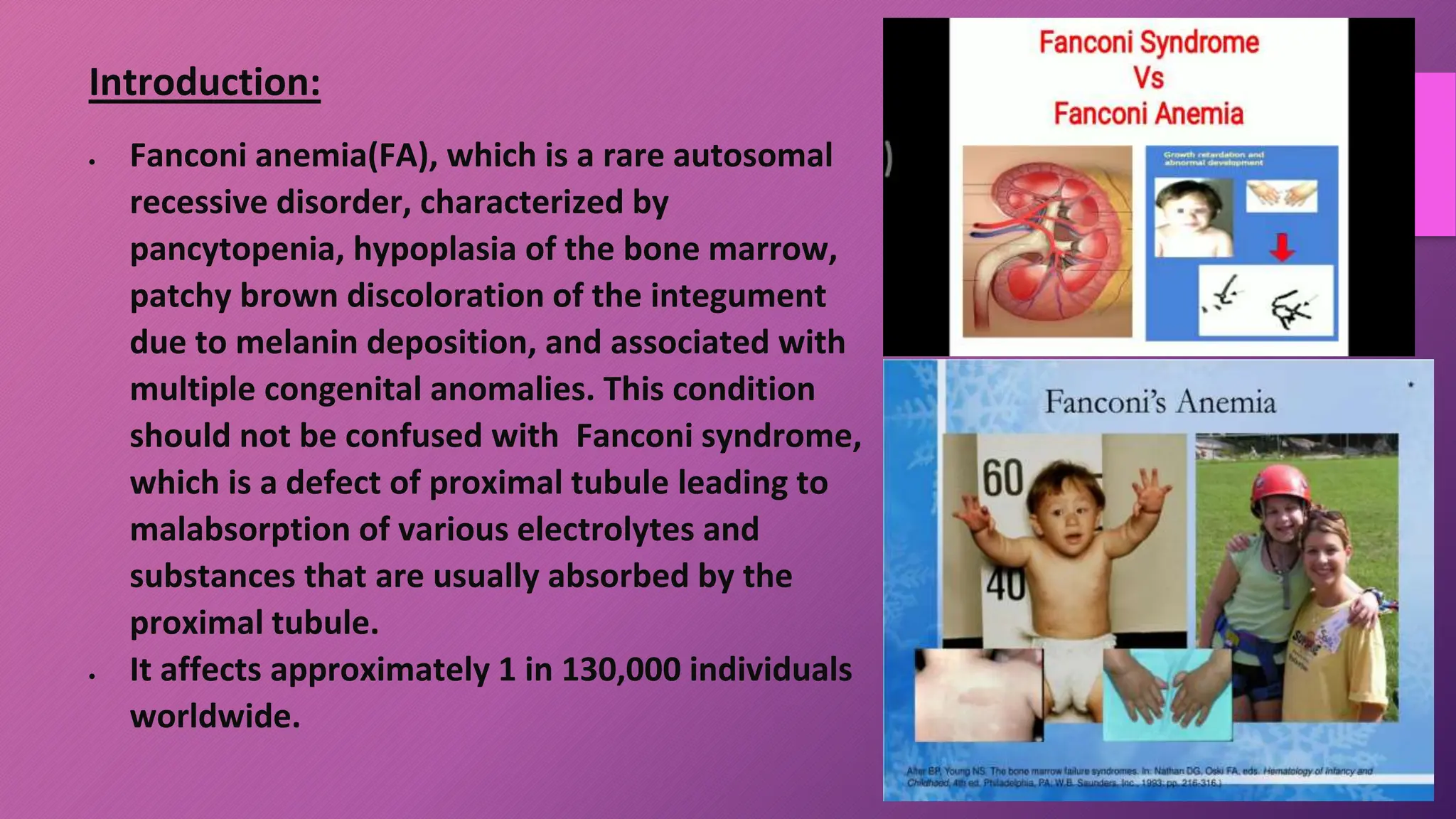 FANCONI ANAEMIA a rare genetic disease.pptx