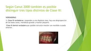 ORTOPEDIA -CLASE III | PDF