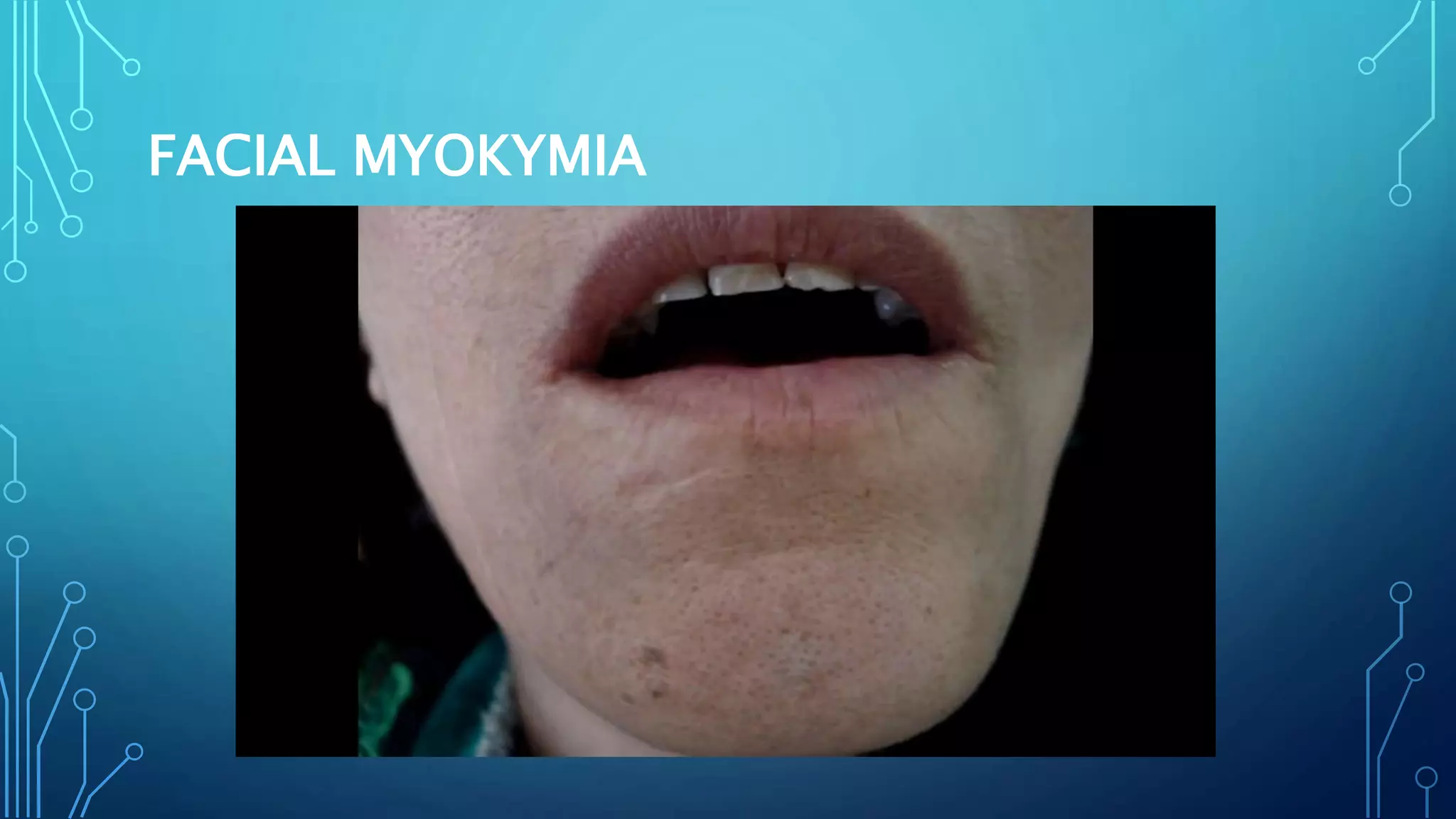 Fantastic facial movements and where to find them 111118 | PPTX