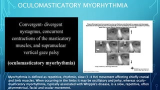Fantastic facial movements and where to find them 111118 | PPTX
