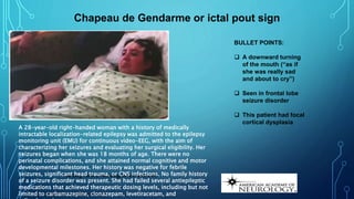 Fantastic facial movements and where to find them 111118 | PPT