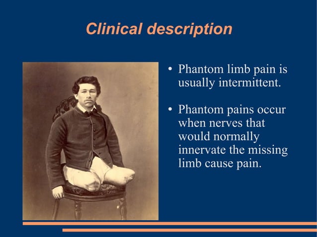 Phantom limb pain | PPT | Physical Therapy | Wellness