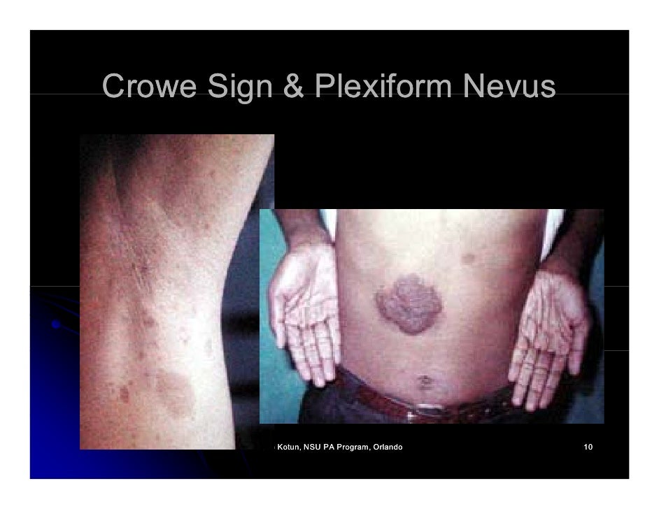 F A P A 2007 Congenital Dermatological Problems