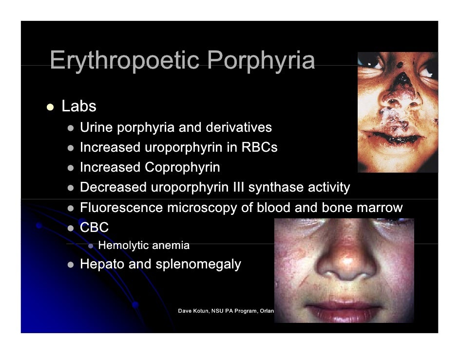 F A P A 2007 Congenital Dermatological Problems