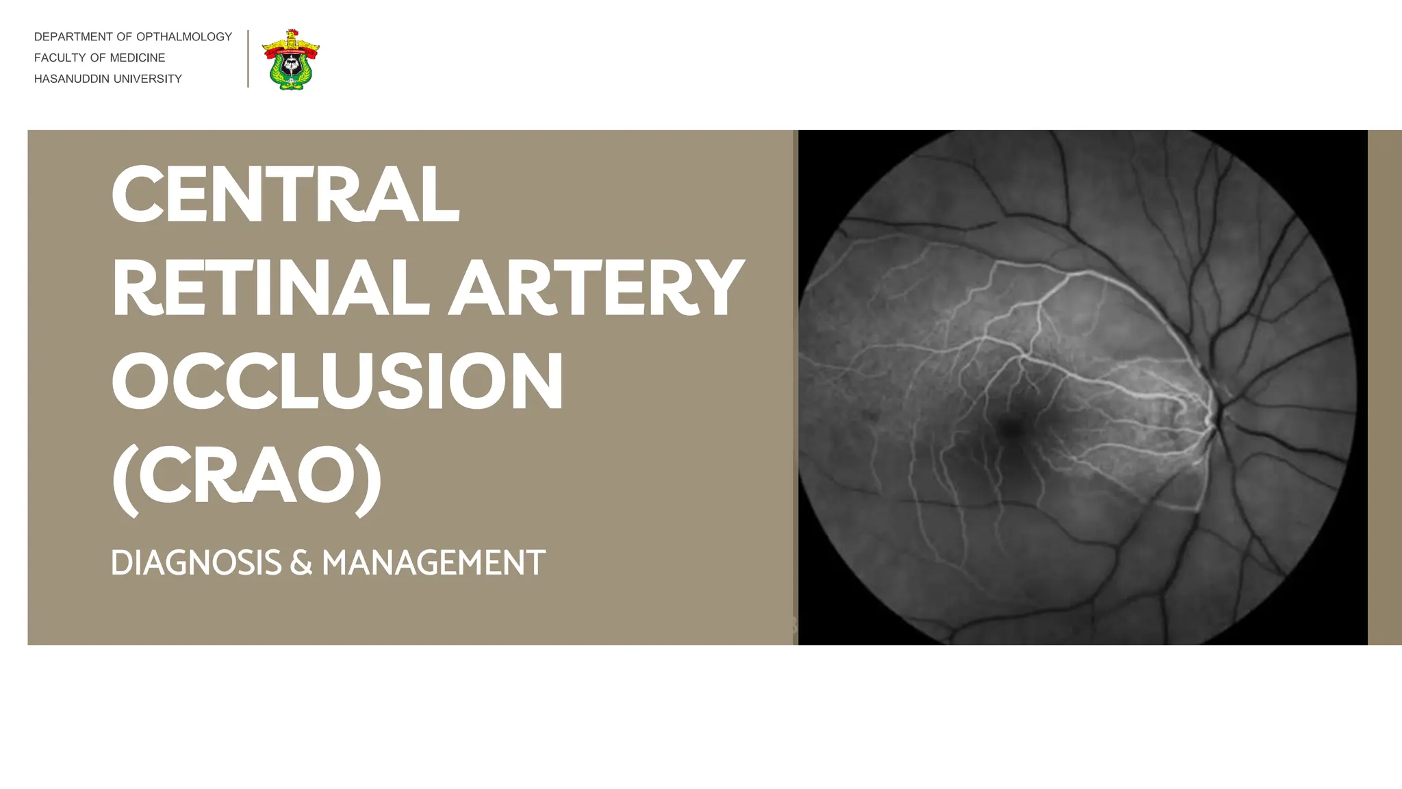DIAGNOSIS AND MANAGEMENT CENTRAL RETINA L ARTERY OCCLUSION | PDF