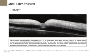 DIAGNOSIS AND MANAGEMENT CENTRAL RETINA L ARTERY OCCLUSION | PDF