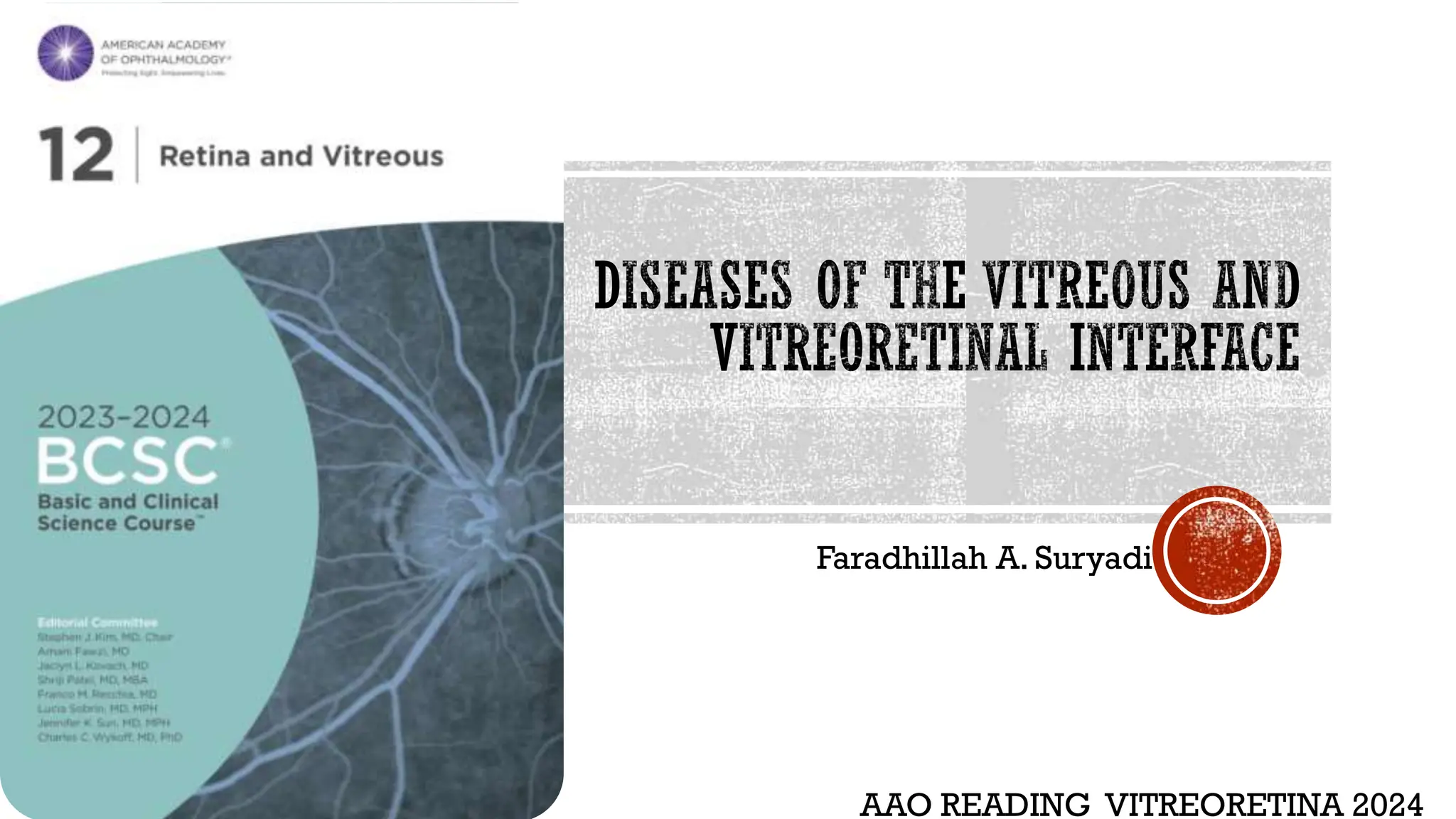 DISEASE OF THE VITREOUS AND VITREORETINAL INTERFACE.pptx