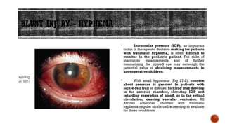 AAO PEDIATRIC OPHTHALMOLOGY OCULAR TRAUMA IN CHILD.pptx
