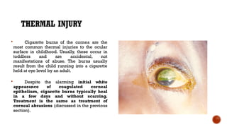 AAO PEDIATRIC OPHTHALMOLOGY OCULAR TRAUMA IN CHILD.pptx
