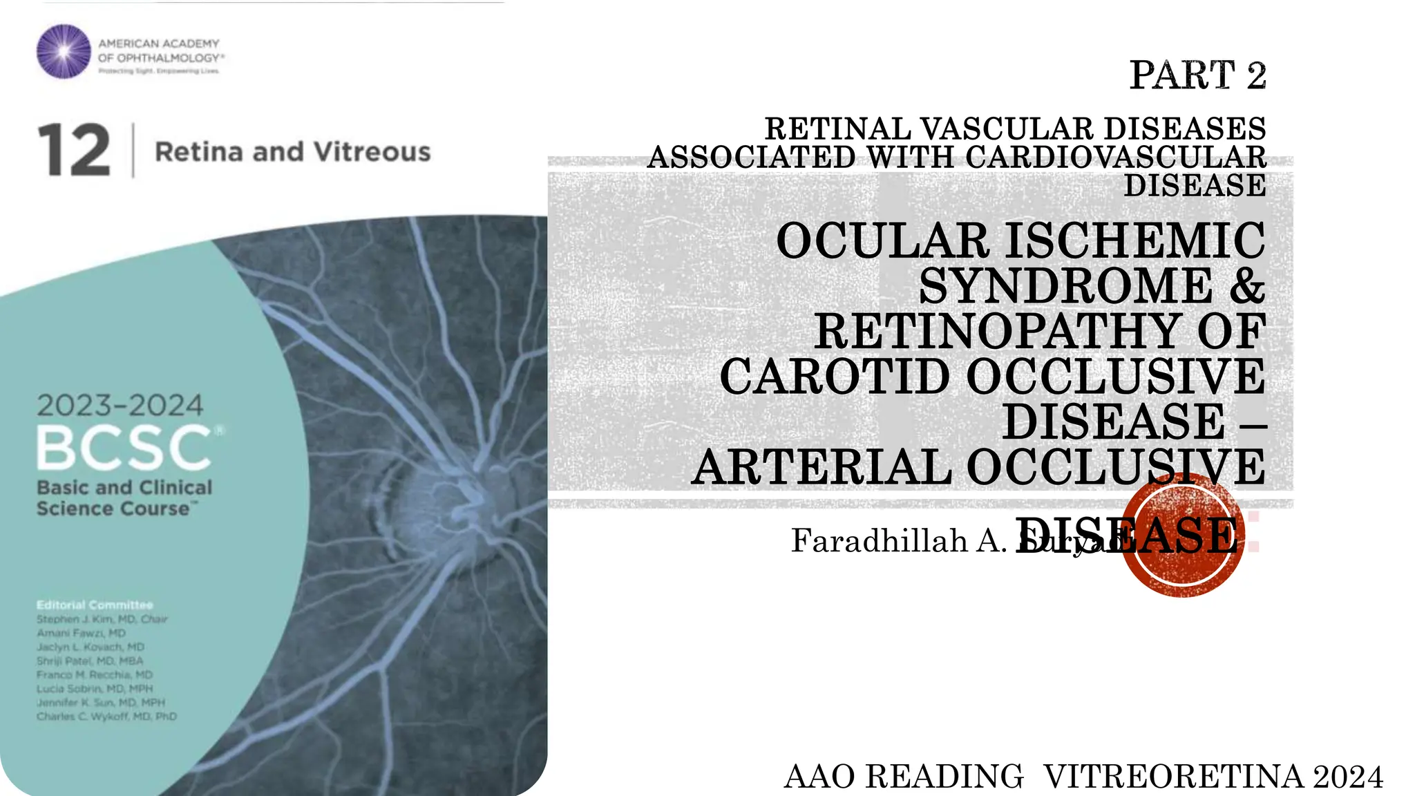 FAR - OIS RAO retinal aretery occlusion AAO | PPT