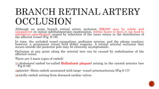 FAR - OIS RAO retinal aretery occlusion AAO | PPT