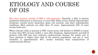 FAR - OIS RAO retinal aretery occlusion AAO | PPT