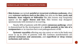 Panuveitis BEHCET DISEASE AAO Reading.pptx