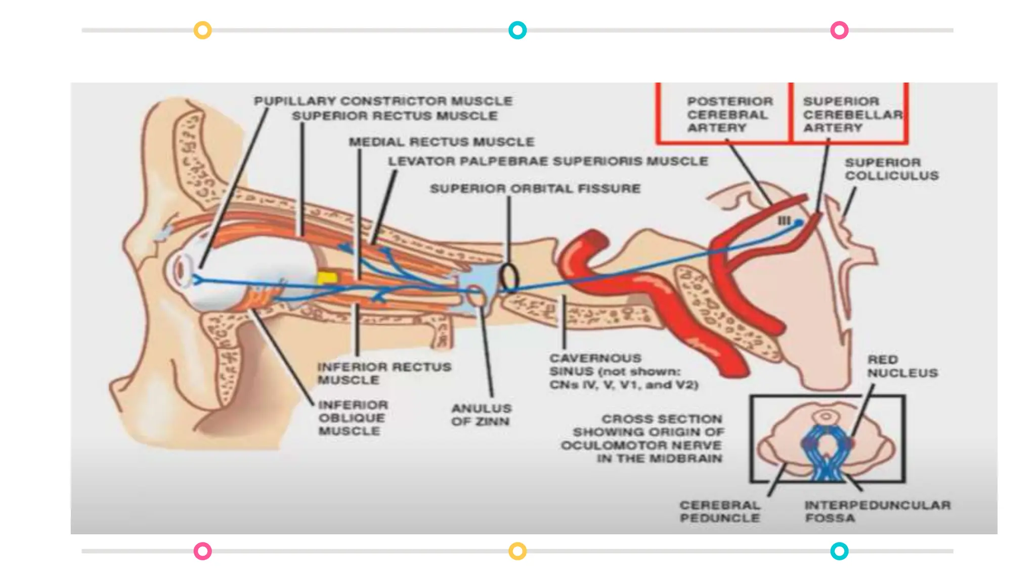 parese n.iii oculomotorius in ophthalmology | PPT