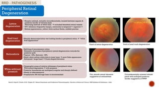 FAR - Rhegmatogenous Retinal Detachment- Diskusi Prof Ichsan.pdf