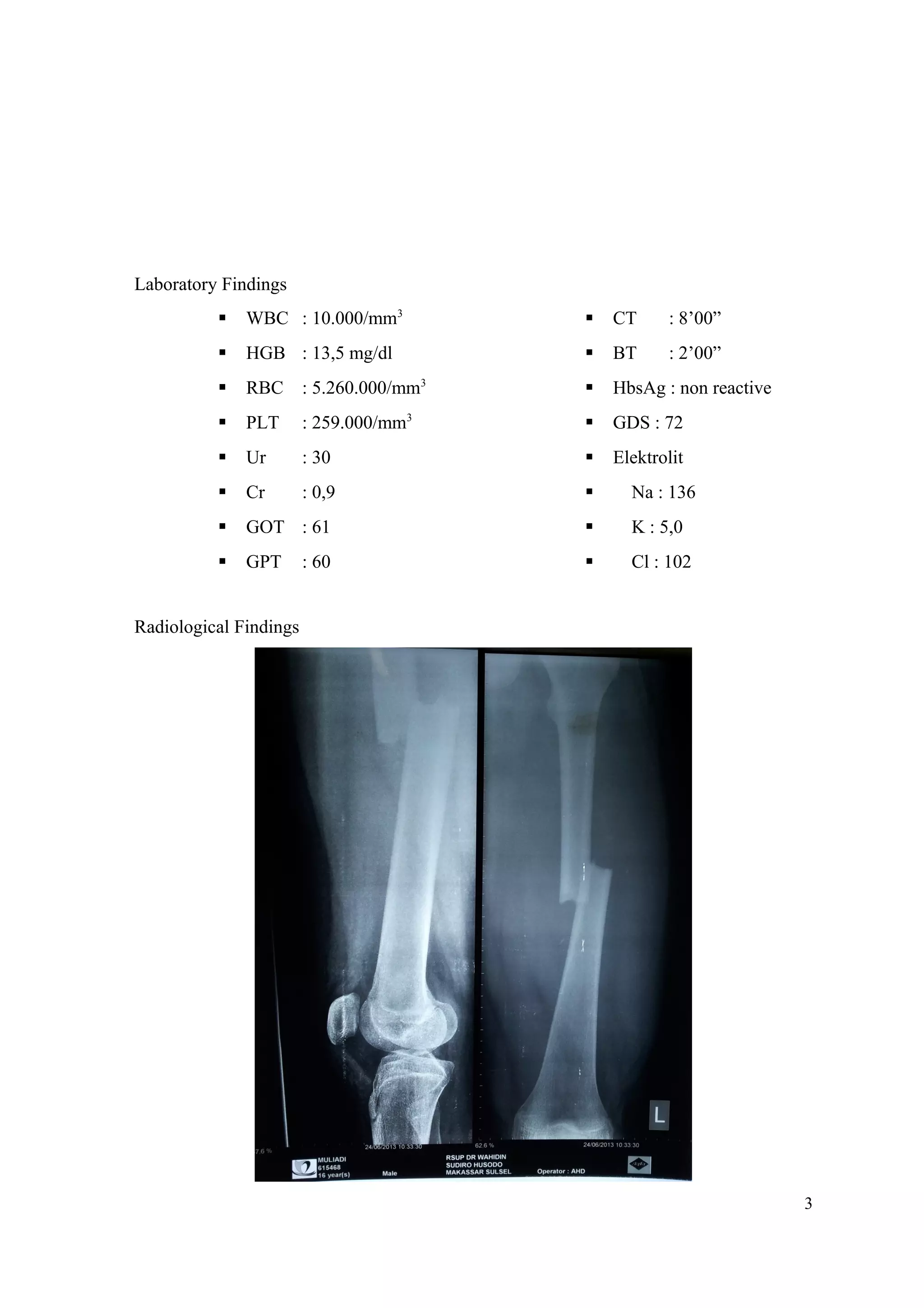 Case Report : closed fracture 1/3 middle left femur | DOC