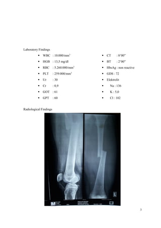 Case Report : closed fracture 1/3 middle left femur | DOC
