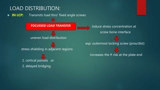 biomechanics of far cortex locking | PPTX