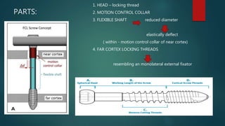 biomechanics of far cortex locking | PPTX