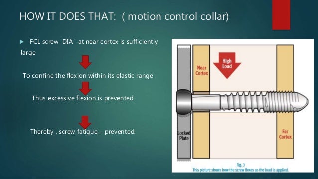 biomechanics of far cortex locking