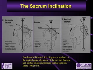 Spine Natural History Through Human Life | PPT