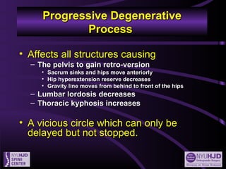 Spine Natural History Through Human Life | PPT