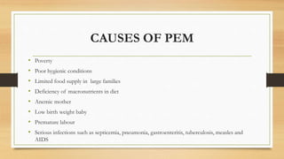 PEM protein Energy Malnutrition | PPTX