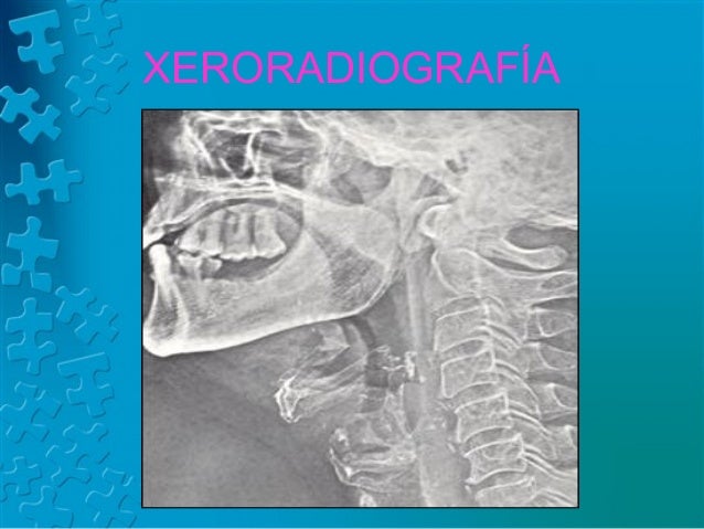 Anatomía Radiológica de Faringe y Laringe