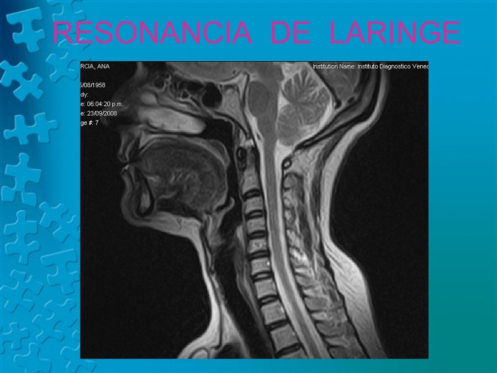 Anatomia Da Faringe