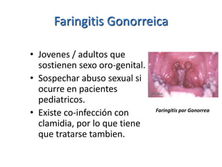 Faringitis | PPTX