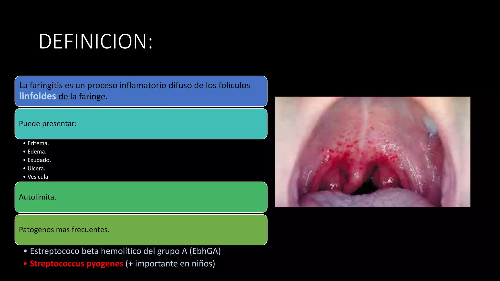 Faringitis aguda | PPTX | Infectious Diseases | Diseases and Conditions