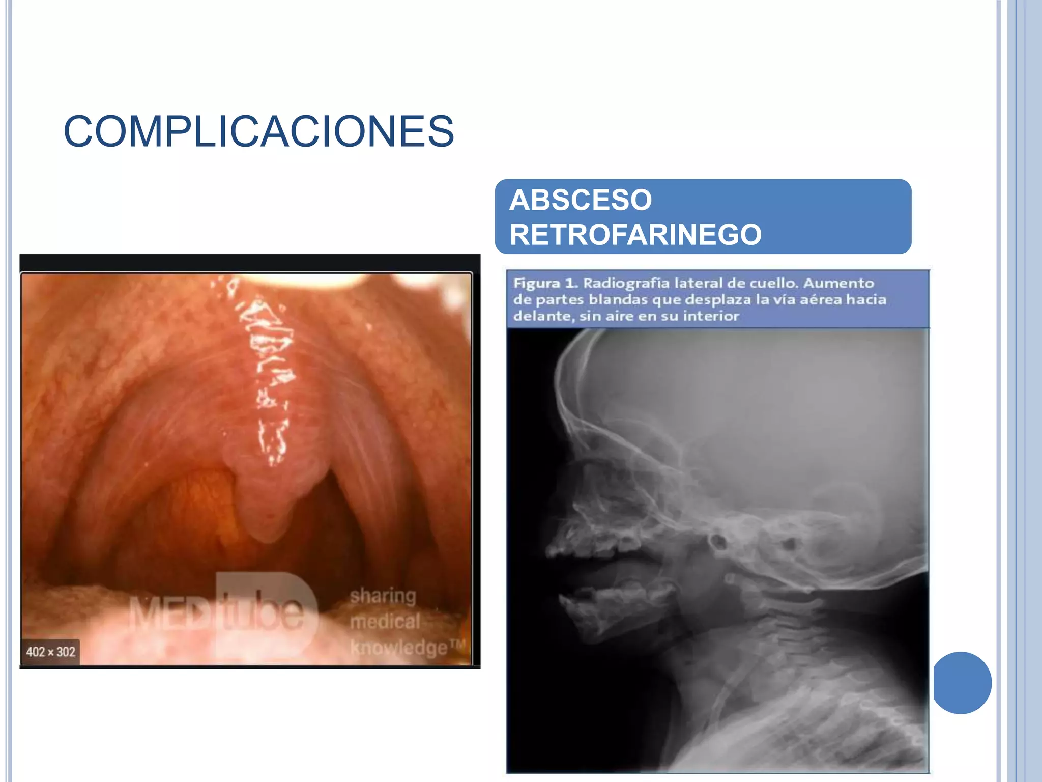 FARINGITIS AGUDA.pptx