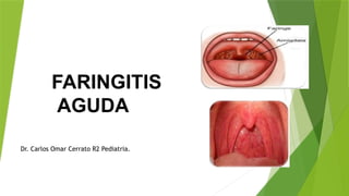 Faringitis Aguda, definición, Criterios de Centor y Manejo.pptx