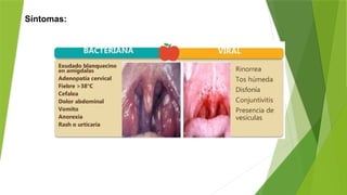 Faringitis Aguda, definición, Criterios de Centor y Manejo.pptx