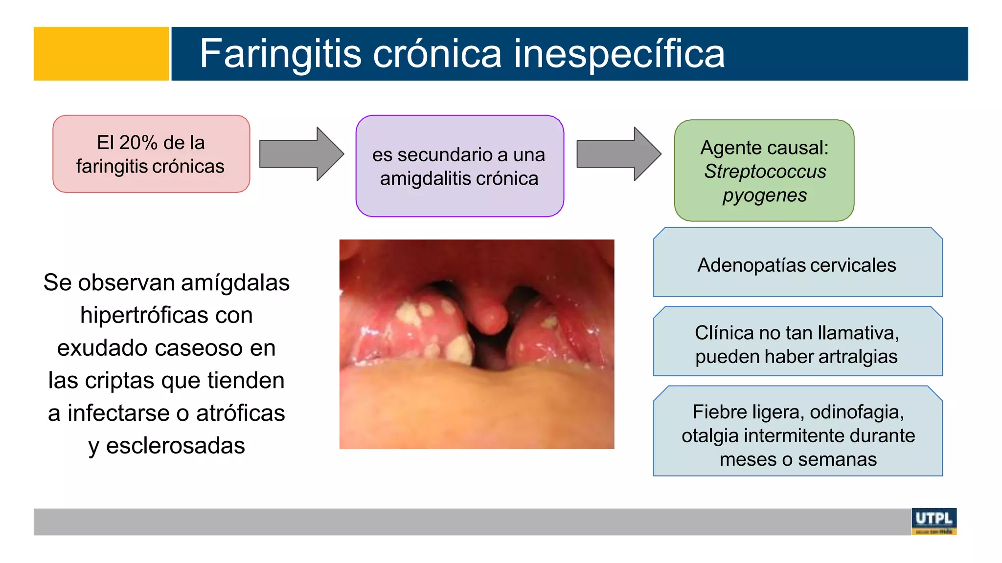 Faringitis aguda y crónica.pptx