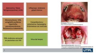 Faringitis aguda y crónica.pptx