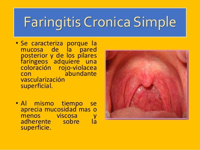 Patologa Inflamatoria Crnica Y Aguda Faringe