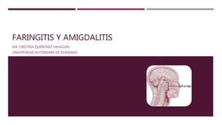 Faringitis y amigdalitis | PPTX