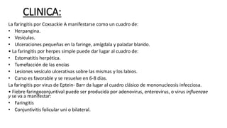 FARINGITIS Y FARINGOAMIGDALITIS.pptx