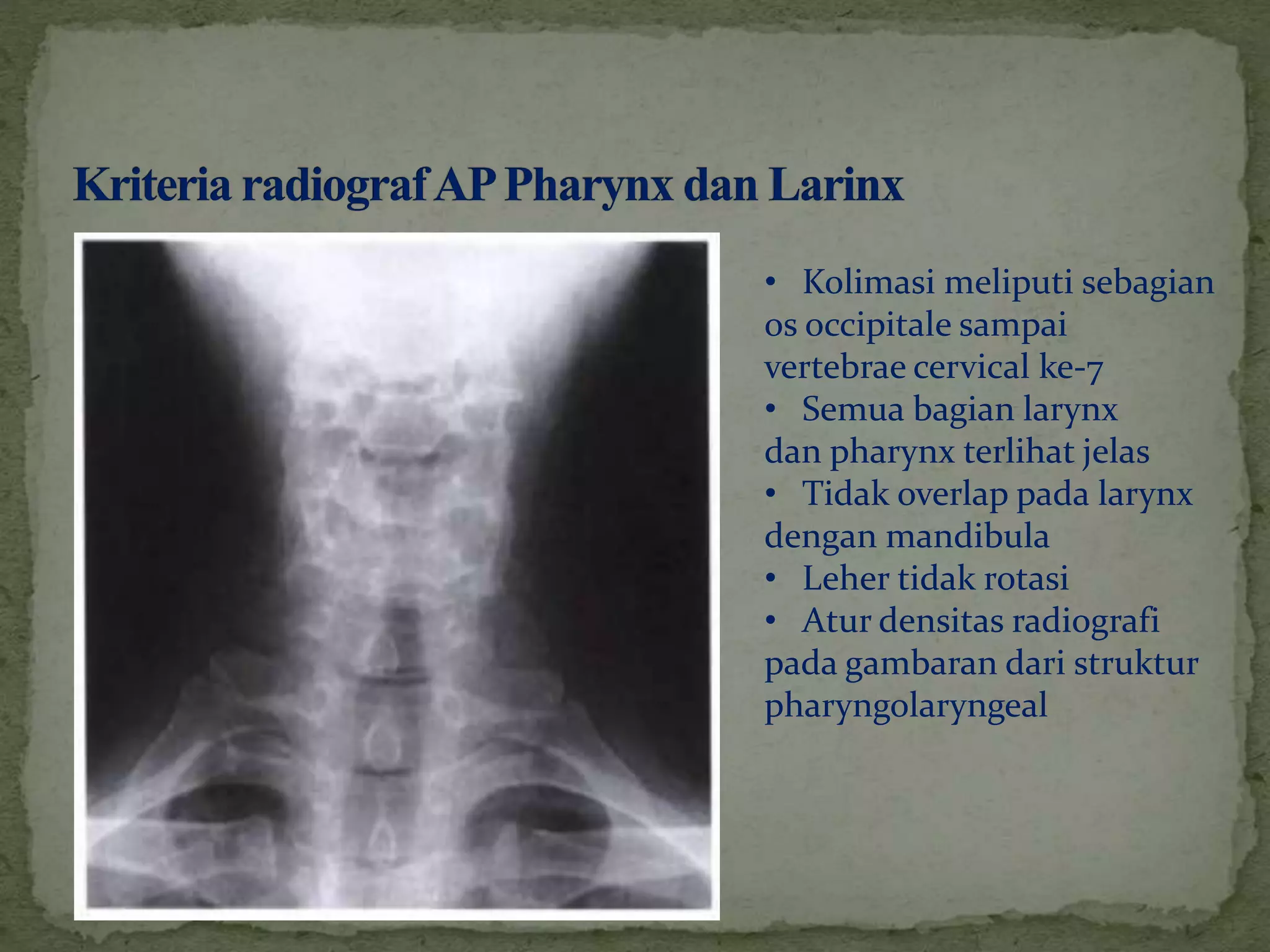 Teknik Pemeriksaan Radiografi Faring laring trakhea | PPTX