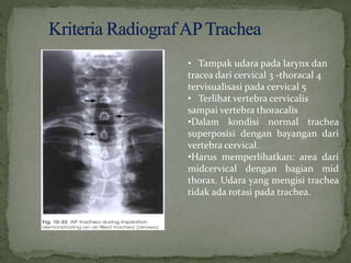 Teknik Pemeriksaan Radiografi Faring laring trakhea | PPTX