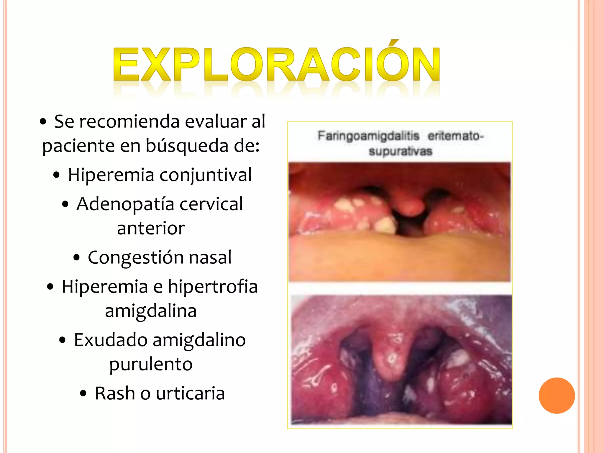 Faringoamigdalitis | PPT