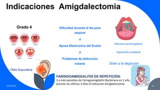 Faringoamigdalitis GPC TRATAMIENTO Y CRITERIOS.pptx