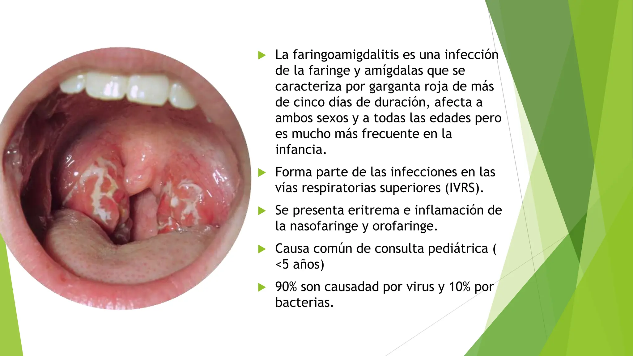 Faringoamigdalitis viral y bacteriana.pptx