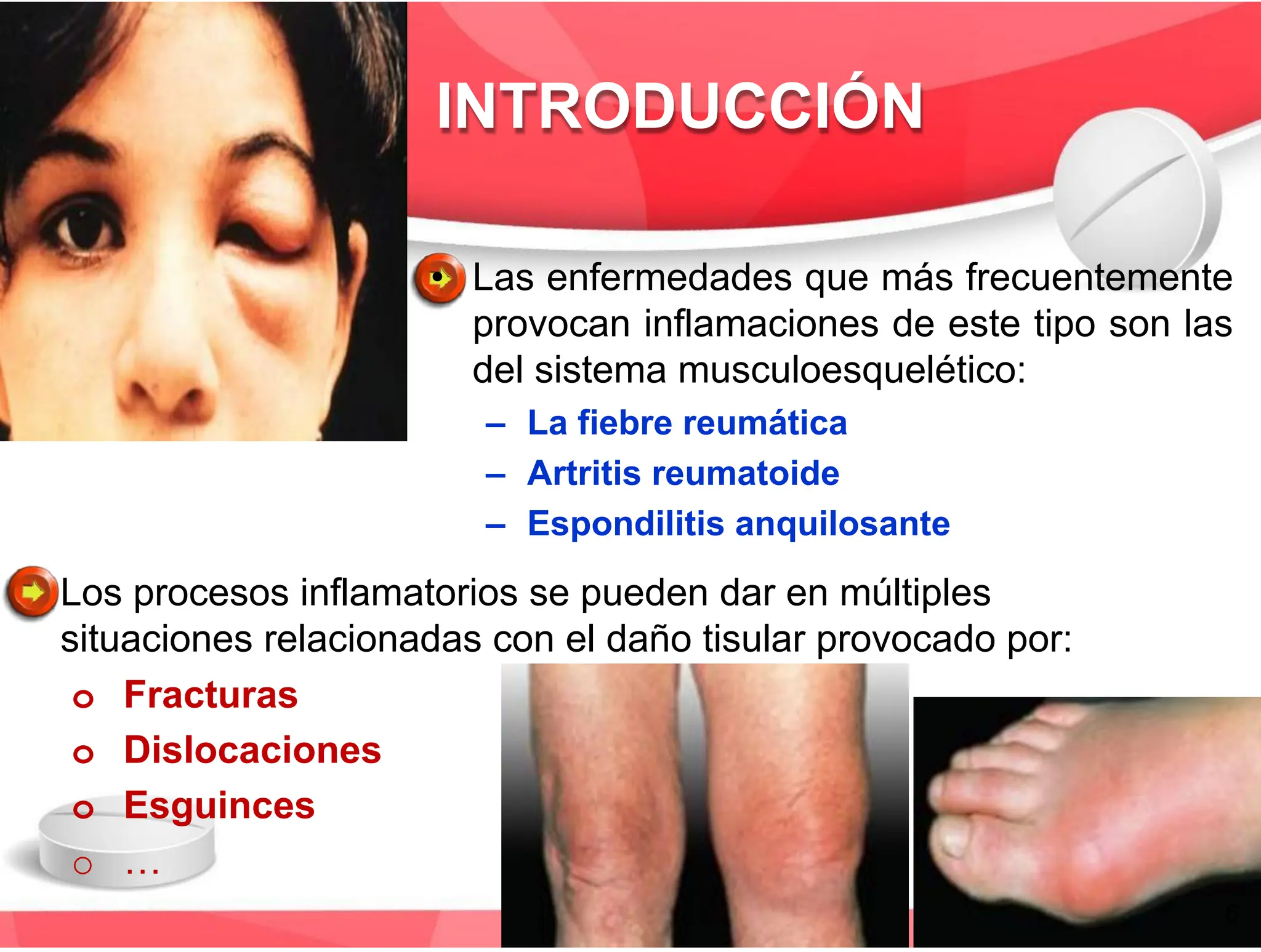 Farmacología AINES.pdf Antiinflamatorios | PPT