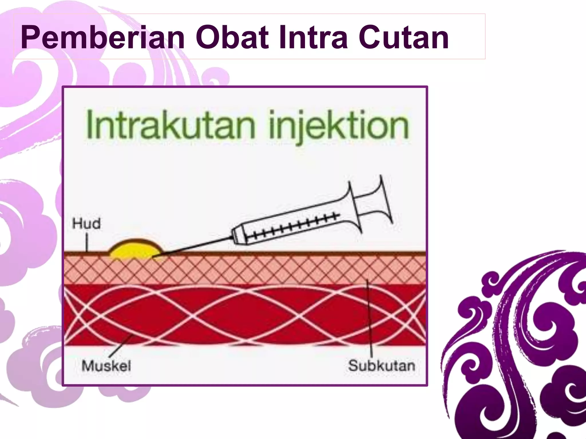 parenteral intracutan | PPTX
