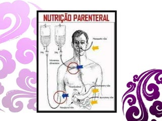 parenteral intracutan | PPTX