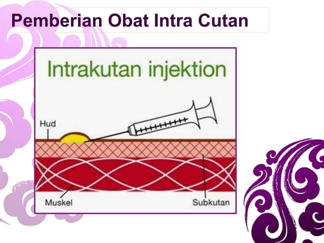 parenteral intracutan | PPTX
