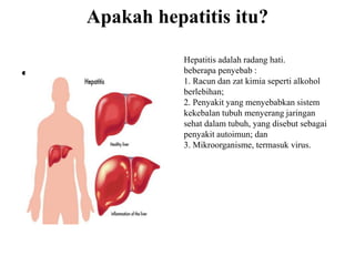 FARMAKOTERAPI DALAM PENYAKIT HEPATITIS PPT | PPTX