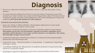 farmers lung etiology diagnosis and treatment -jila.pptx